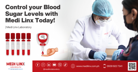 Fasting Blood Sugar FBS Test (Fasting Blood Glucose)