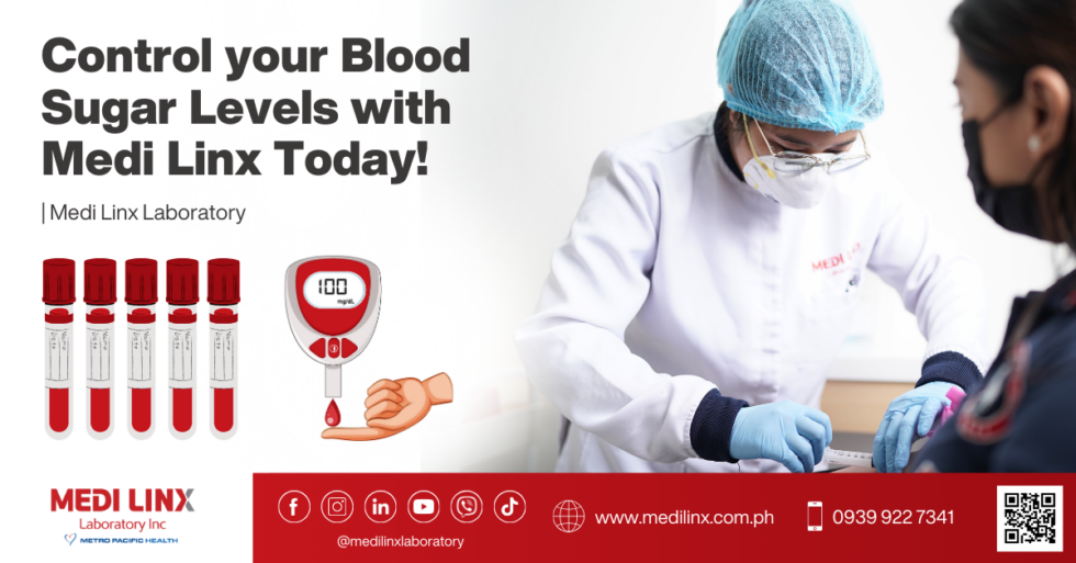 Fasting Blood Sugar FBS Test (Fasting Blood Glucose)