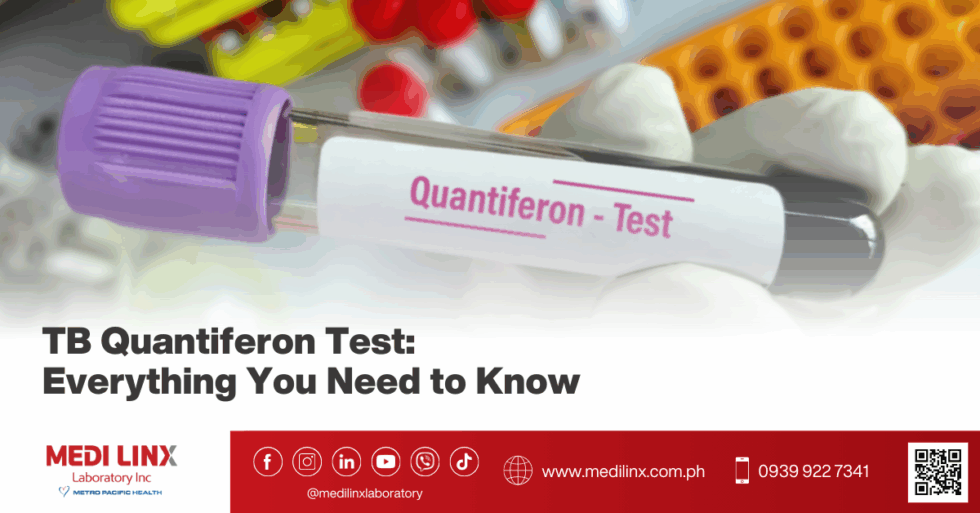 TB Quantiferon | Medi Linx Laboratory Inc.