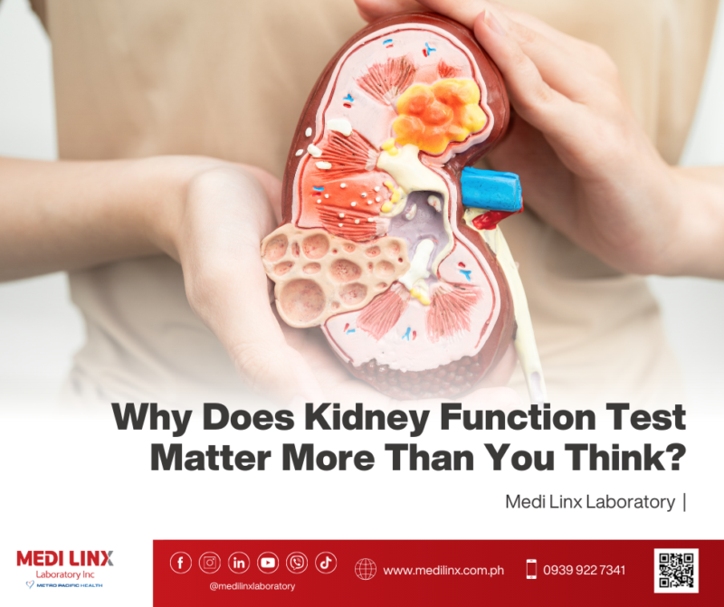 Kidney Function Test - Medi Linx Laboratory Inc.